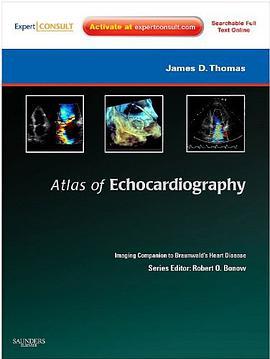 Atlas of Echocardiography_百度百科