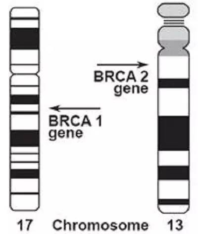 BRCA1基因_百度百科