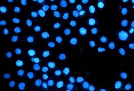 hoechst_百度百科