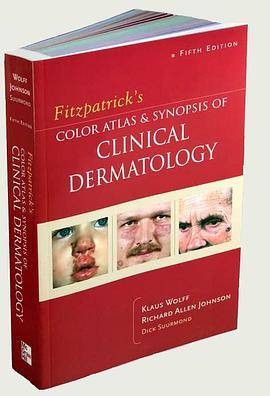 Color Atlas and Synopsis of Clinical Dermatology, CD-ROM_百度百科