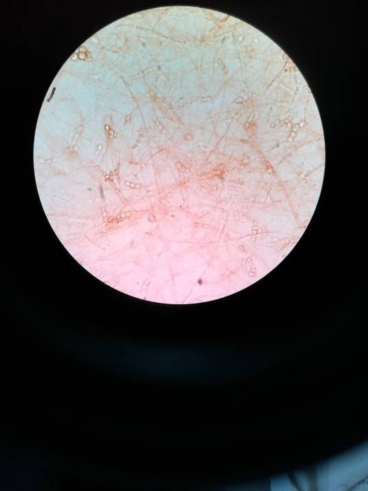 厚垣孢子_百度百科