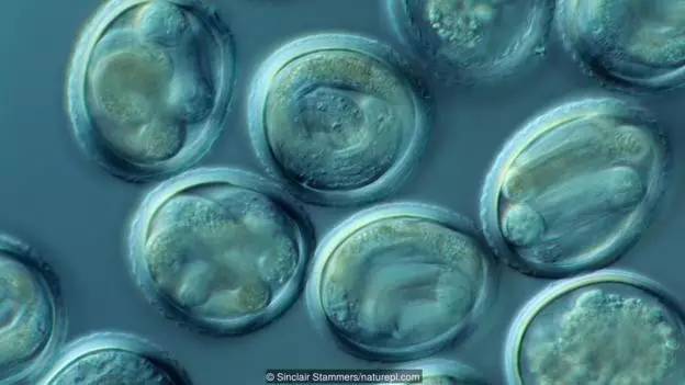 地球上最大和最小性细胞:小得难以置信 大得令人惊奇_百科TA说