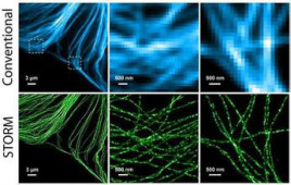 随机光学重建显微法_百度百科