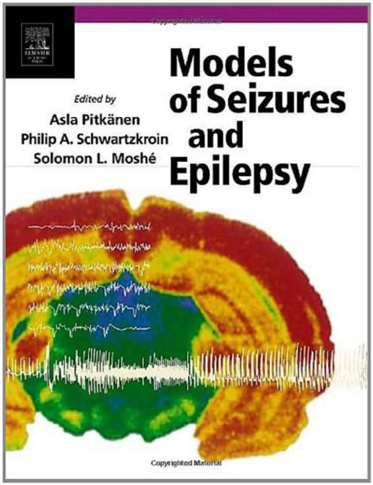 Models of Seizures and Epilepsy_百度百科