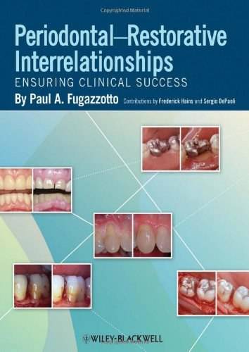 Periodontal-Restorative Interrelationships_百度百科