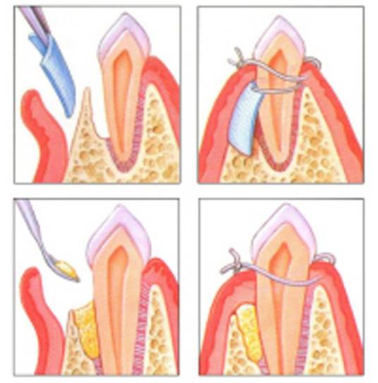 GBR技术_百度百科