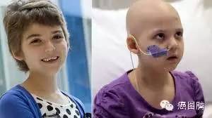 CAR-T越滚越快 进入实体瘤受阻_百科TA说