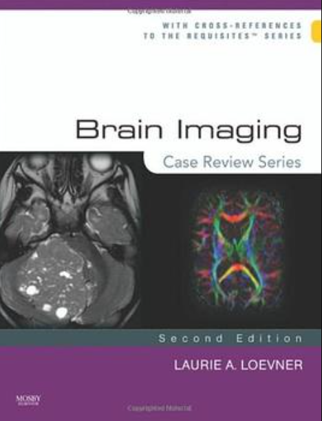 Brain Imaging_百度百科