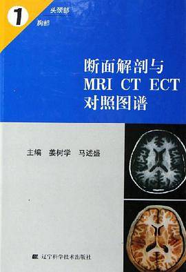 断面解剖与MRI CT ECT对照图谱(1)-头颈部胸部_百度百科