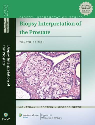 Biopsy Interpretation of the Prostate_百度百科