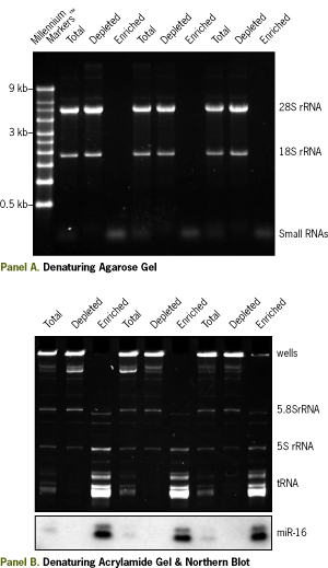 Total RNA_百度百科