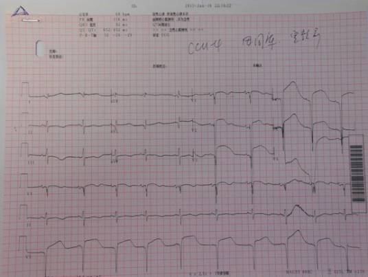 QTc间期_百度百科