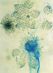 梨形卷枝霉_百度百科