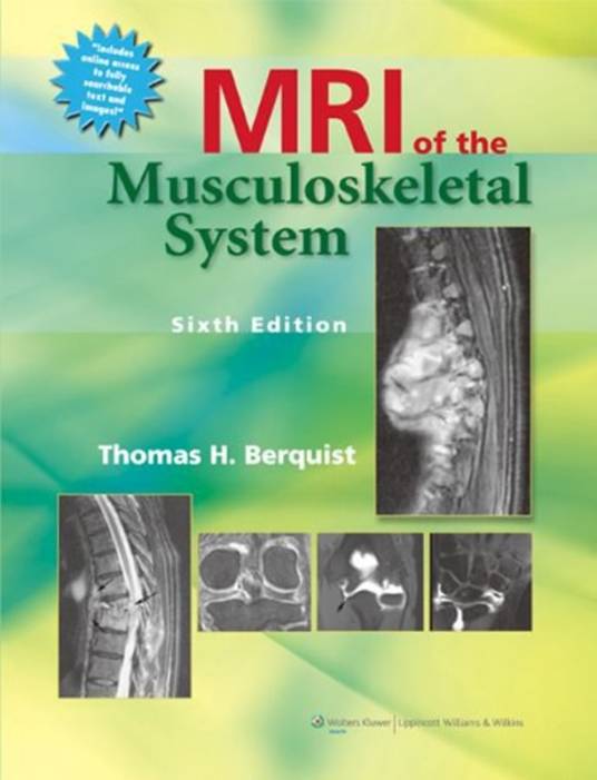 MRI of the Musculoskeletal System_百度百科