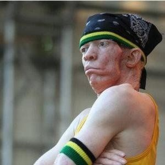 Yellowman_百度百科