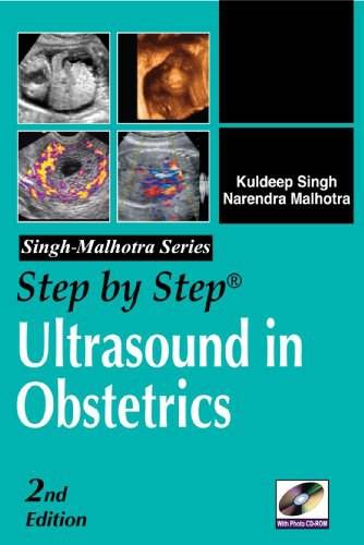 Step by Step Ultrasound in Obstetrics_百度百科