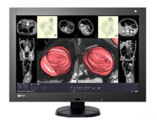 Eizo RadiForce RX430_百度百科