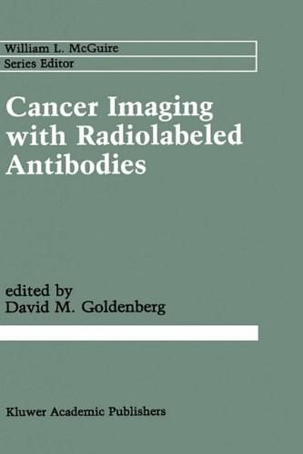 Cancer Imaging with Radiolabelled Antibodies_百度百科