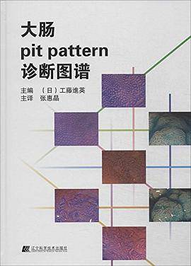 大肠pit pattern诊断图谱_百度百科