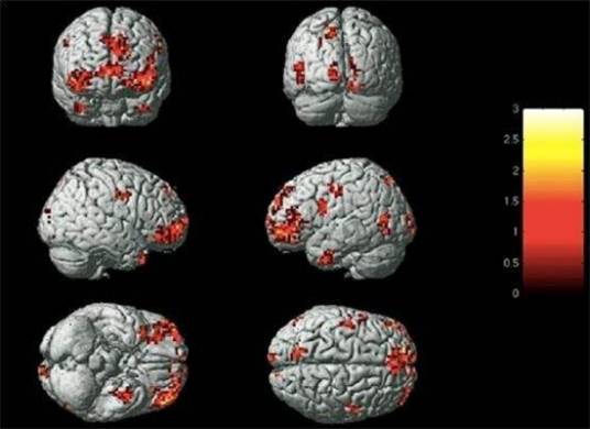 fMRI技术_百度百科