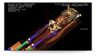 open inventor_百度百科