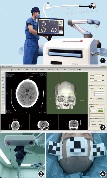 Remebot 医疗机器人_百度百科