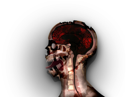 Necroa病毒_百度百科