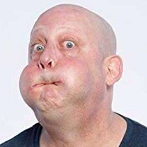 Peter Pitofsky_百度百科