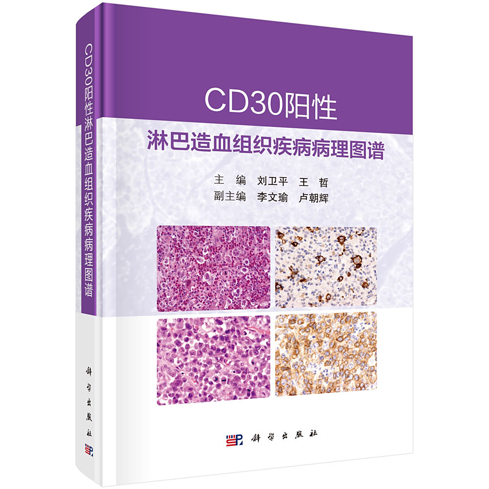 CD30阳性淋巴造血组织疾病病理图谱_百度百科