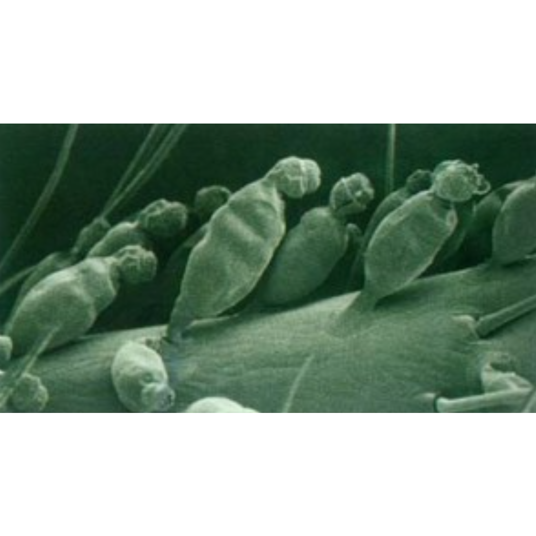 Symbion pandora_百度百科