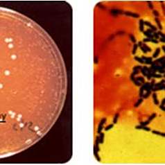 LGG益生菌_百度百科